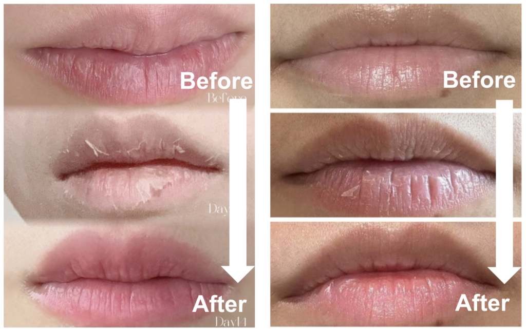 ローマピンクを導入検討されているサロン・クリニック様へ｜ローマピンク正規販売代理店Dr.Visea | 株式会社Dr.Visea/ドクタービセア