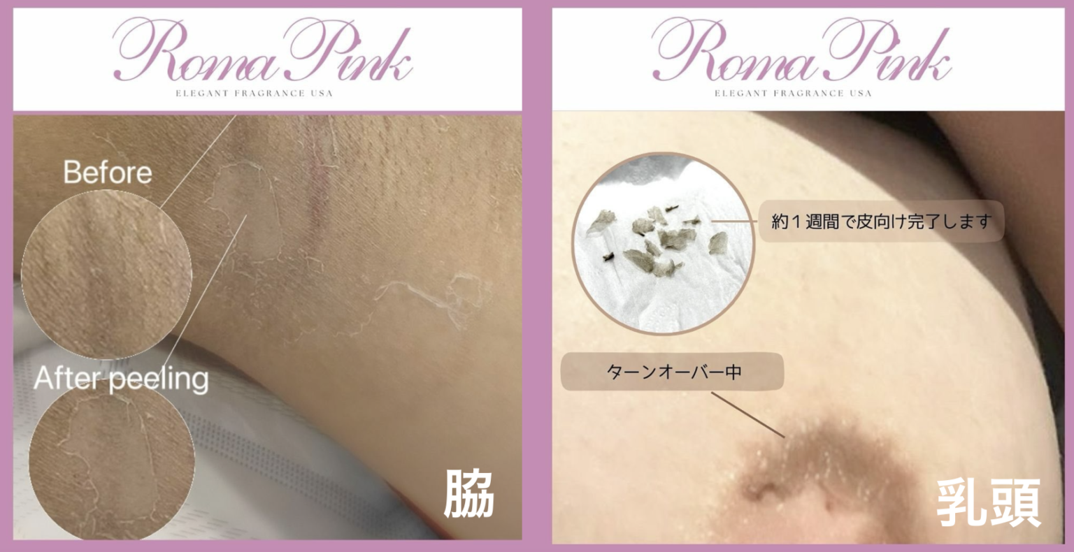 ローマピンクを導入検討されているサロン・クリニック様へ｜ローマピンク正規販売代理店Dr.Visea | 株式会社Dr.Visea/ドクタービセア